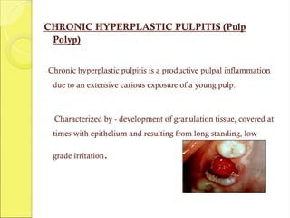 Pulp and periapical pathology presntation part 2 | PPT