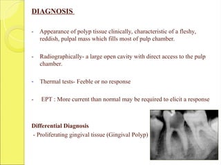 Pulp and periapical pathology presntation part 2 | PPT