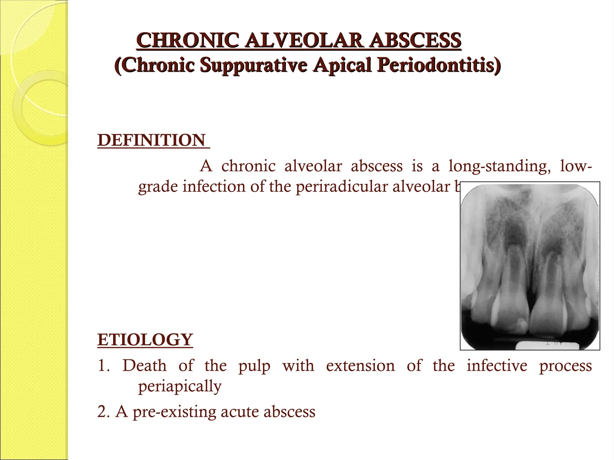 Pulp and periapical pathology presentation part 3 | PPT