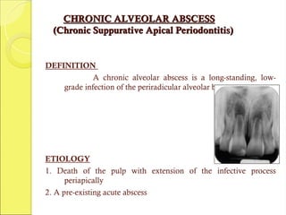 Pulp and periapical pathology presentation part 3 | PPT