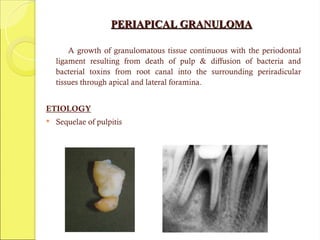 Pulp and periapical pathology presentationpart 4 | PPT