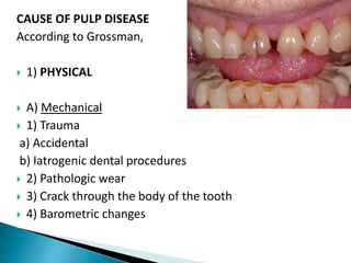 Pulp and periapical etiology | PPTX