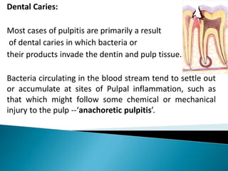 Pulp and periapical etiology | PPTX