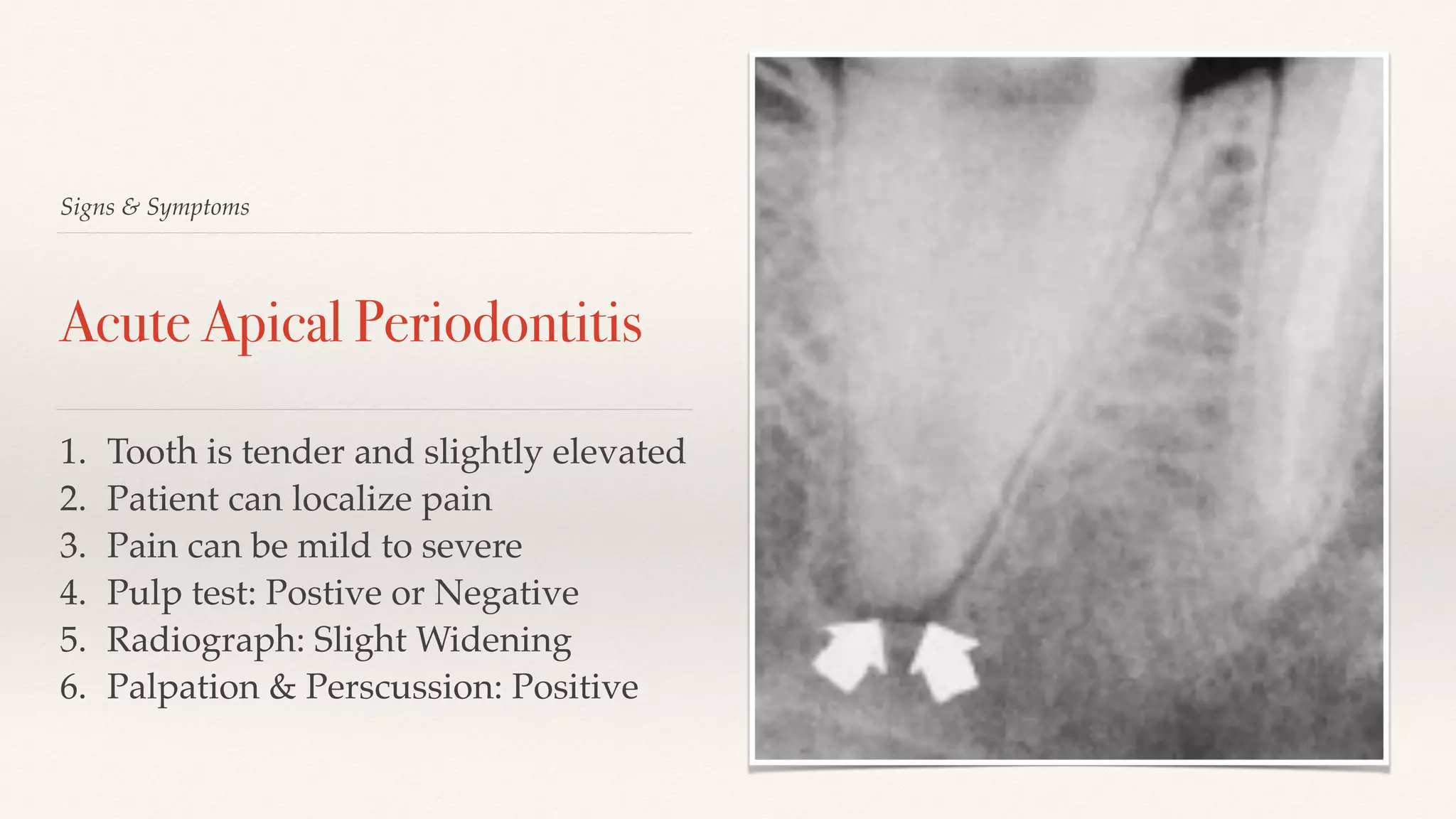 Pulp & periapical disease | PPT