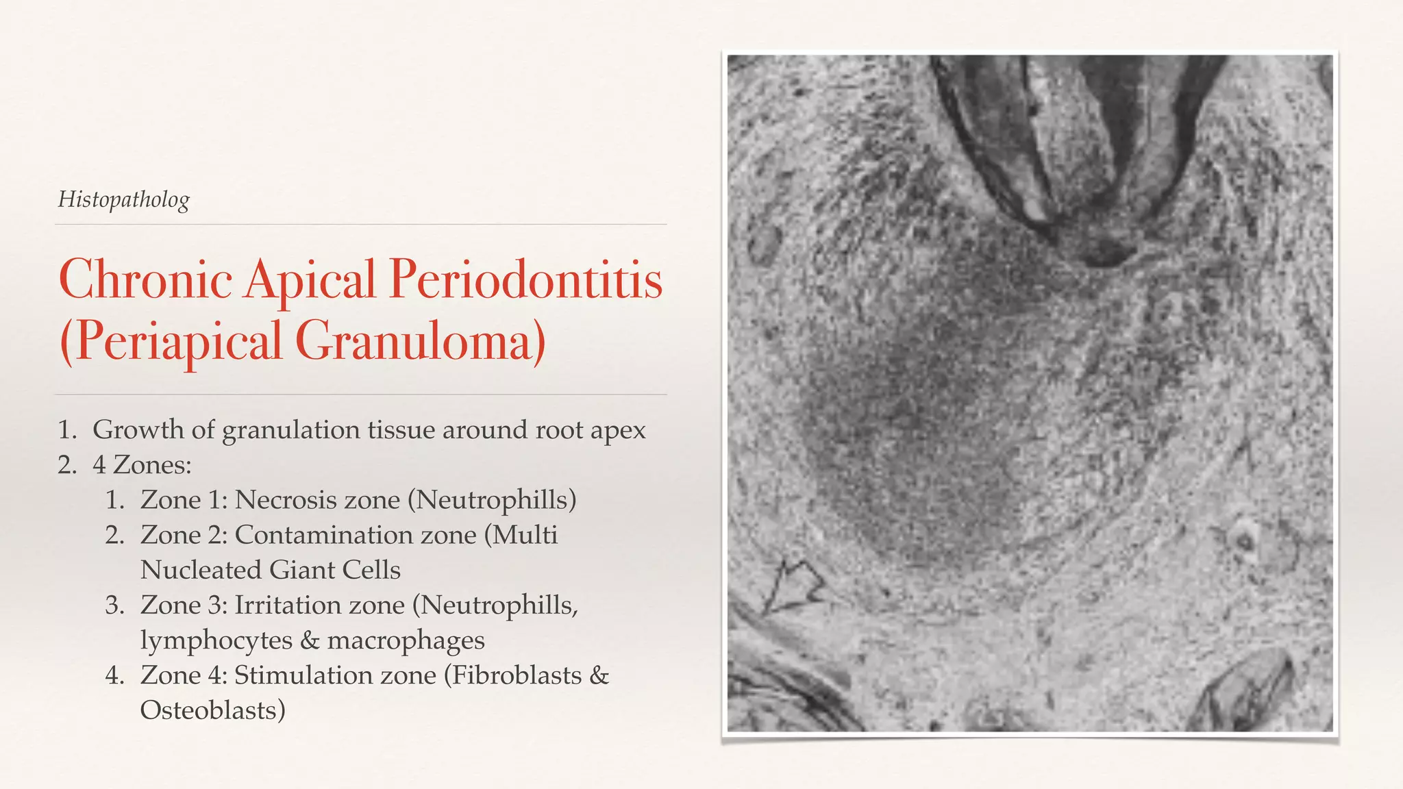 Pulp & periapical disease | PPT