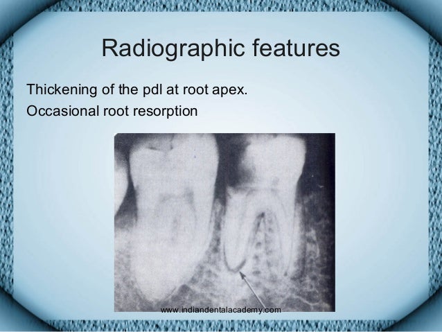 PULP AND PERIAPICAL DISEASES-2 / oral surgery courses