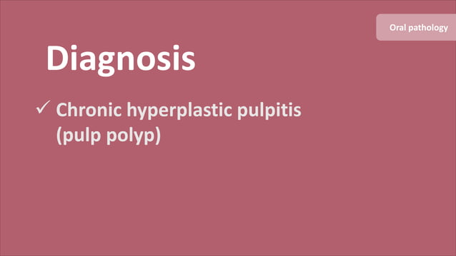 Pulp polyp | PPTX