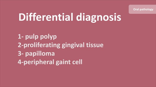 Pulp polyp | PPTX