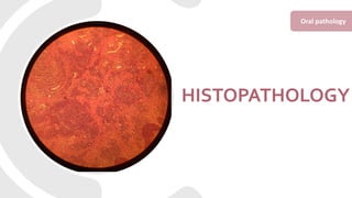 Pulp polyp | PPTX