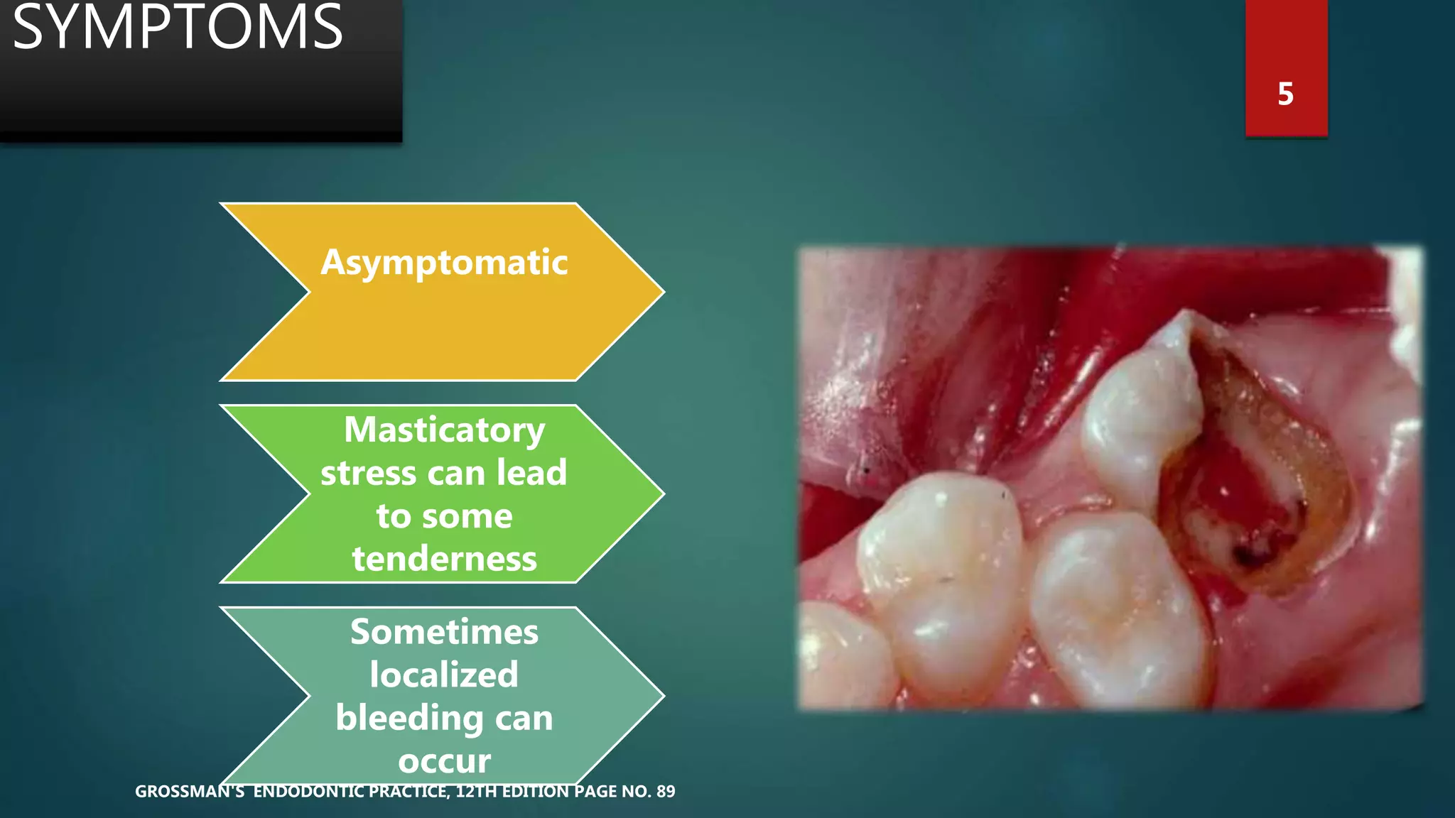 Pulp polyp ...Dr.Anubhuti | PPTX