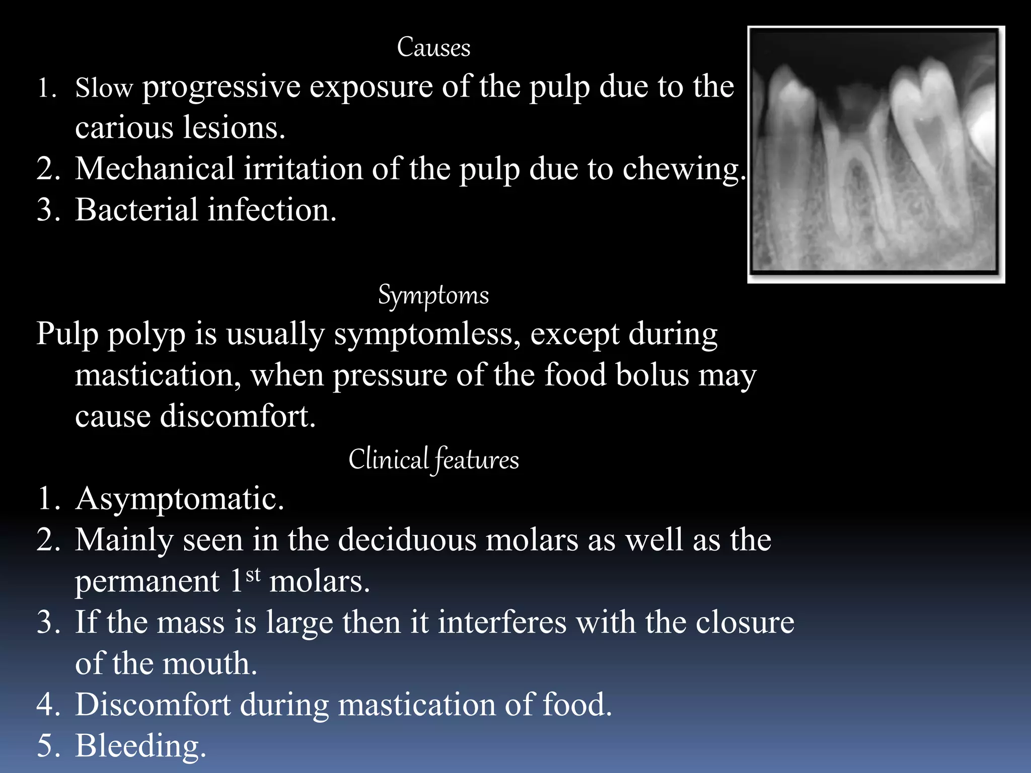 Pulp polyp and gingival polyp | PPTX