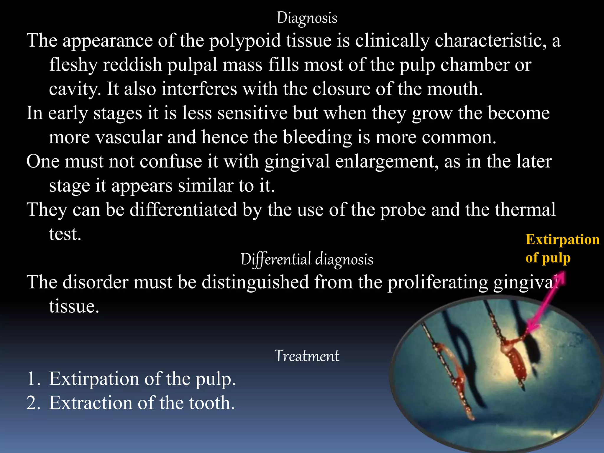 Pulp polyp and gingival polyp | PPTX