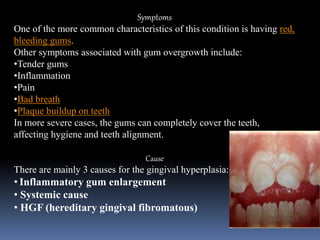 Pulp polyp and gingival polyp | PPTX