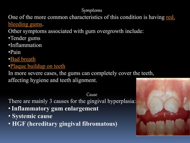 Pulp polyp and gingival polyp | PPTX