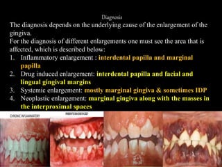 Pulp polyp and gingival polyp | PPTX
