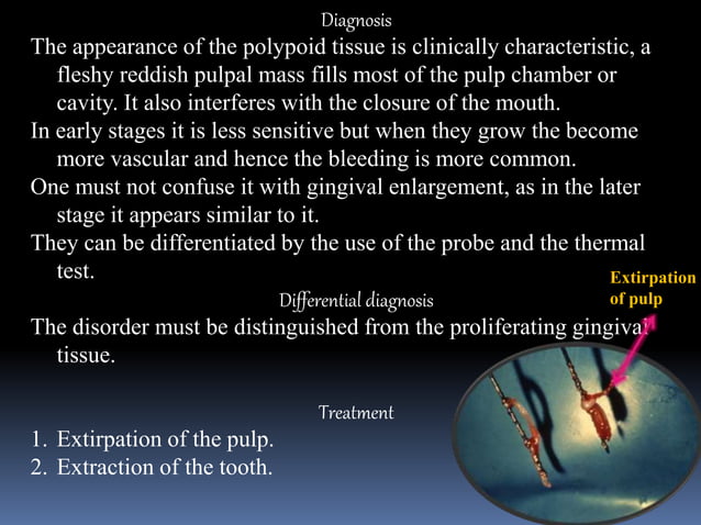 Pulp polyp and gingival polyp | PPTX