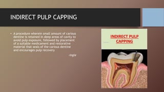 Pulp protection | PPTX