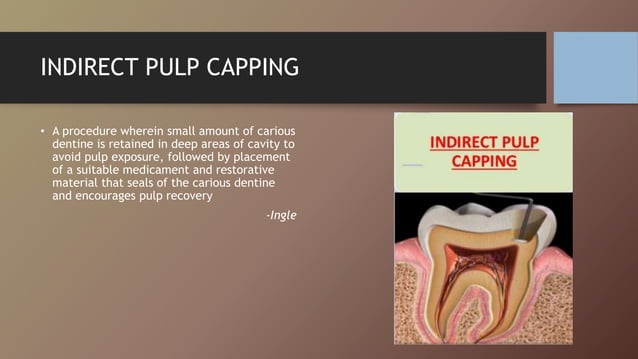 Pulp protection | PPTX