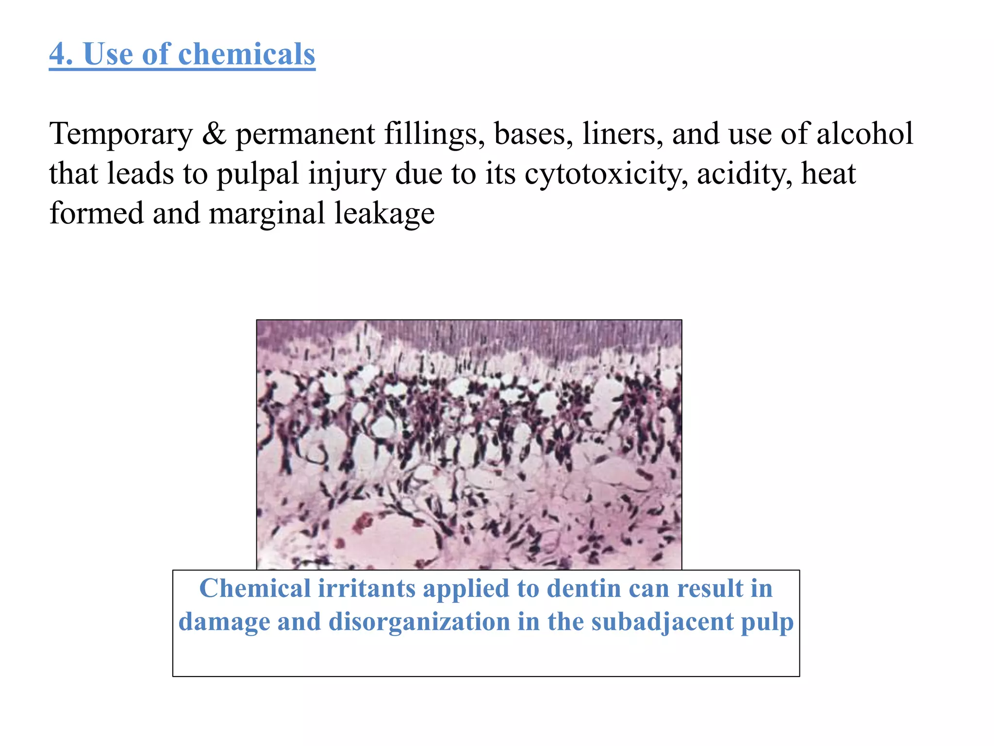 Pulp protection | PPTX