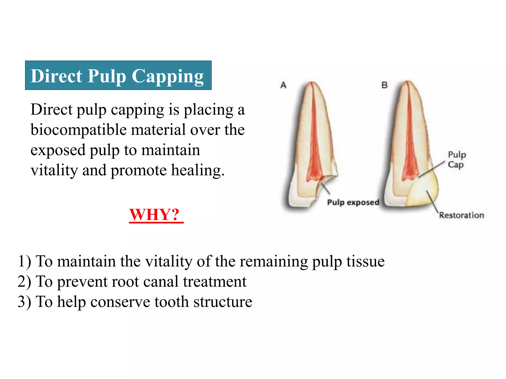 Pulp protection | PPTX