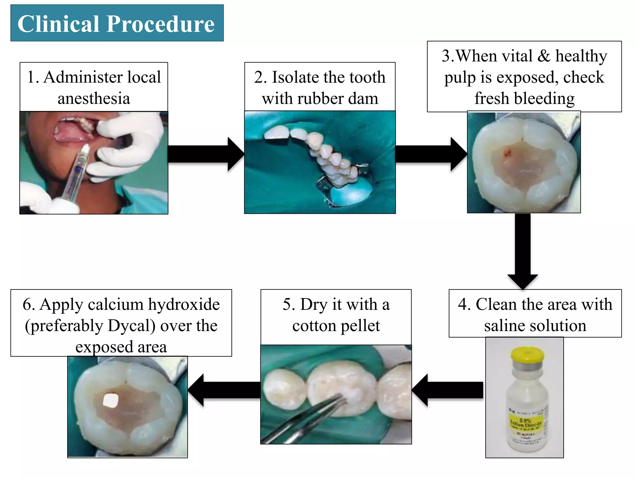 Pulp protection | PPTX