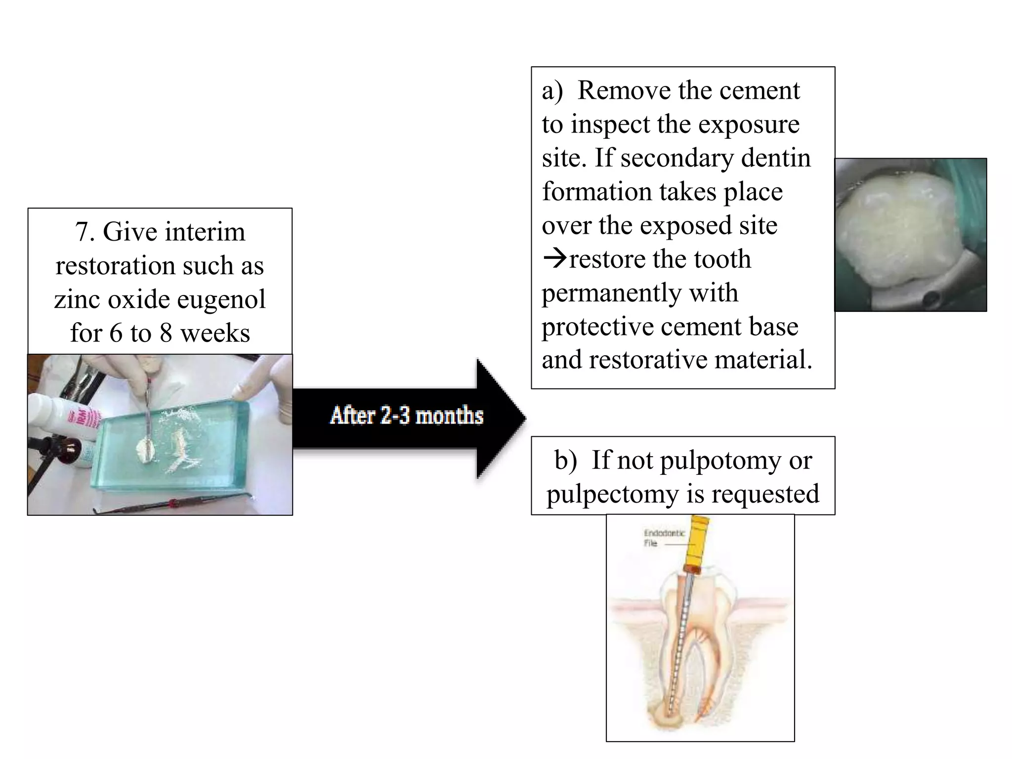 Pulp protection | PPTX