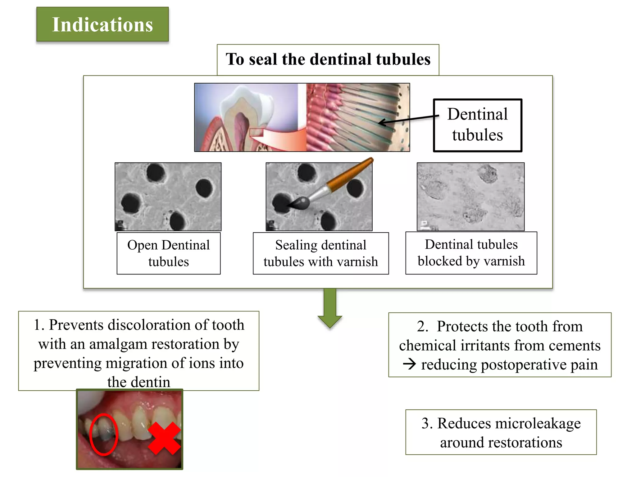 Pulp protection | PPTX