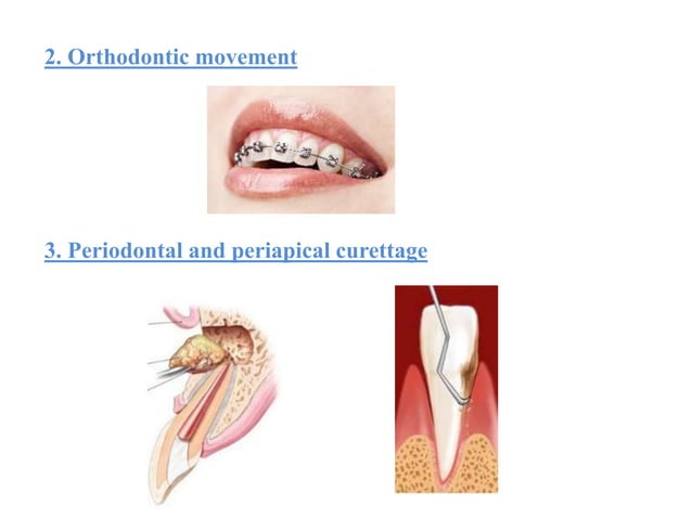 Pulp protection | PPTX