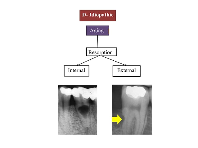 Pulp protection | PPTX