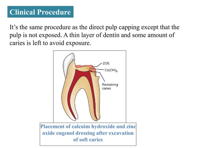 Pulp protection | PPTX
