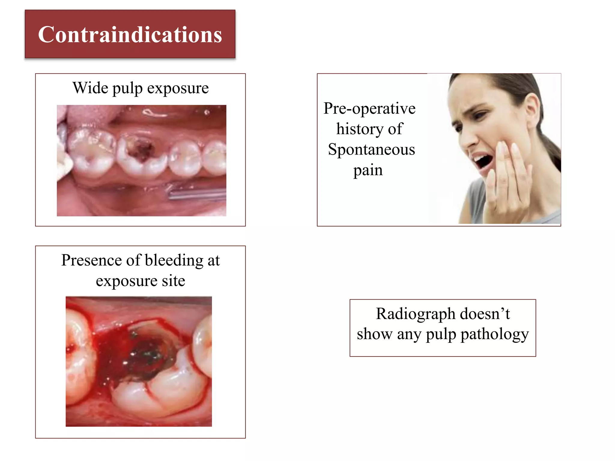 Pulp protection | PPTX
