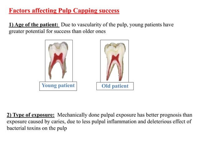 Pulp protection | PPTX