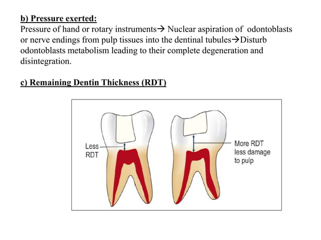 Pulp protection | PPTX