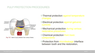 Pulp protection during operative dentistry treatment by dr. ebsa | PPT