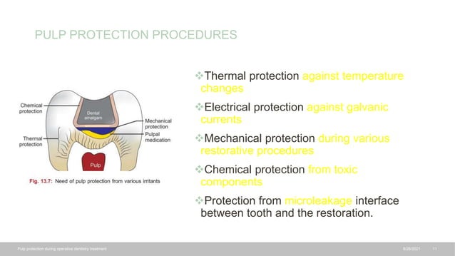 Pulp protection during operative dentistry treatment by dr. ebsa | PPTX