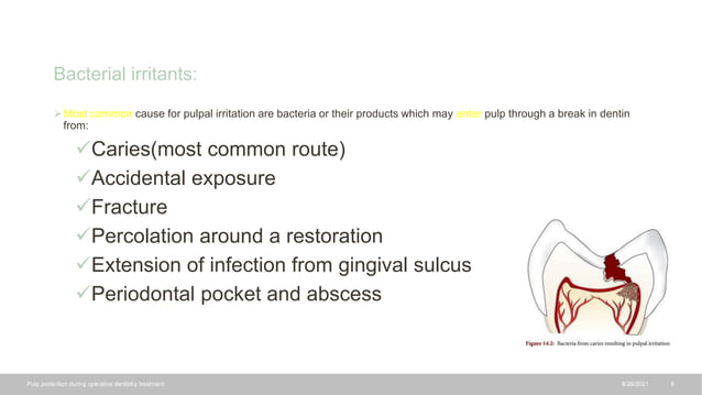 Pulp protection during operative dentistry treatment by dr. ebsa | PPTX