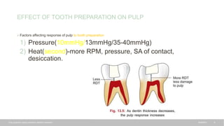 Pulp protection during operative dentistry treatment by dr. ebsa | PPT