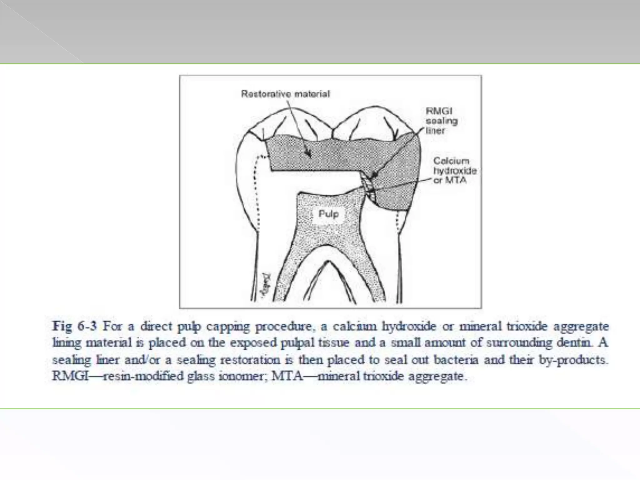 Pulp protection in operative dentistry | PPT