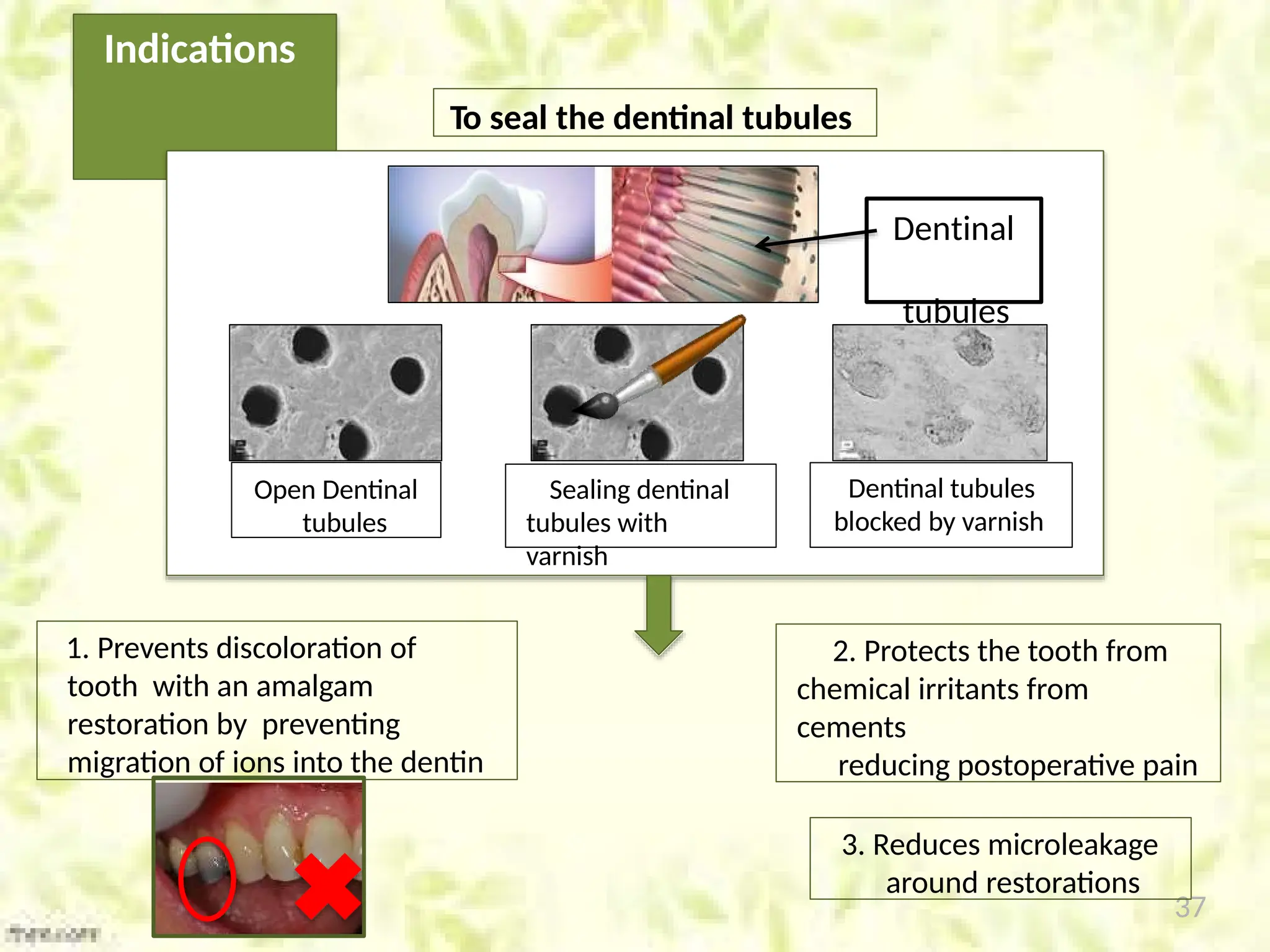 pulp protection varinsh pptx of conservative | PPT