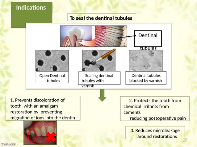 pulp protection varinsh pptx of conservative | PPT