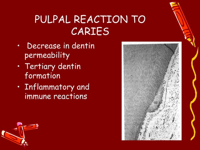 pulp protection | PPT
