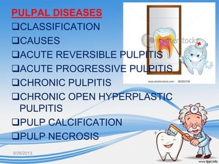 Pulp & pulpal diseases | PPTX