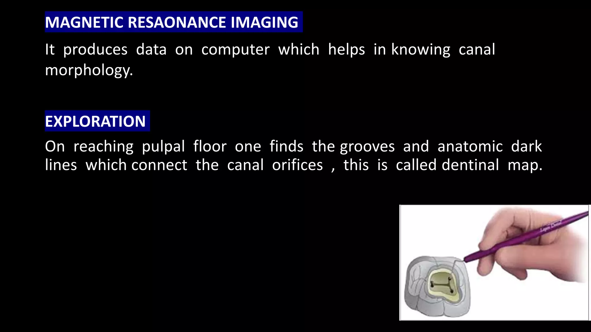 Internal Anatomy of Pulp cavity | PPTX