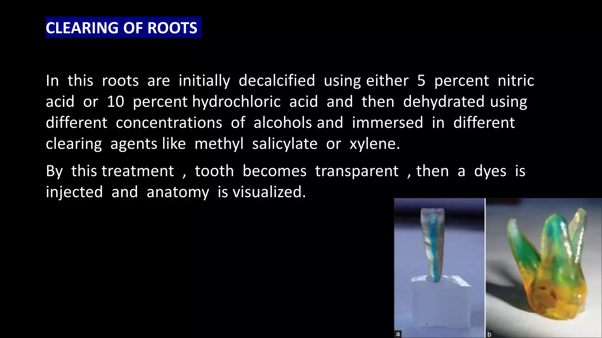 Internal Anatomy of Pulp cavity | PPTX