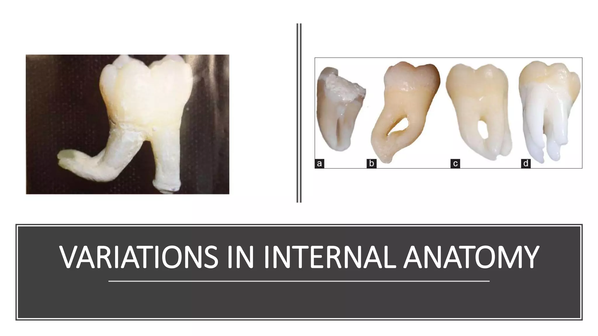 Internal Anatomy of Pulp cavity | PPTX