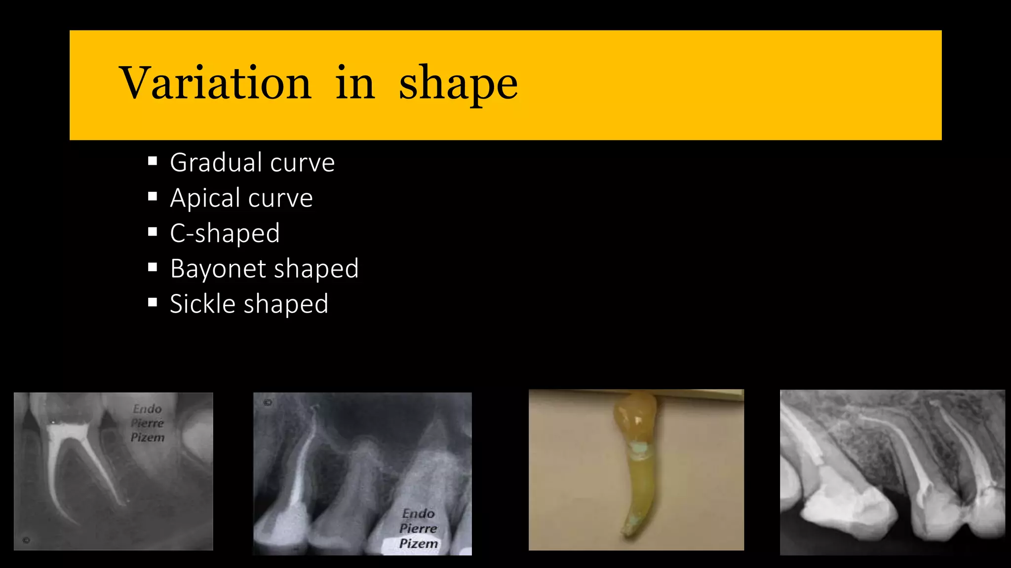 Internal Anatomy of Pulp cavity | PPTX