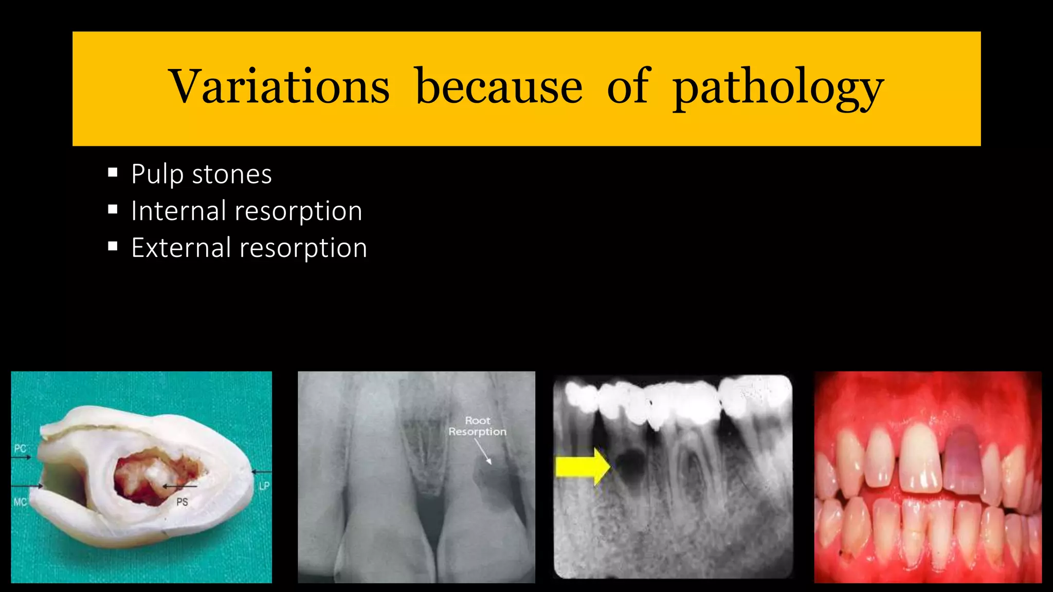 Internal Anatomy of Pulp cavity | PPTX
