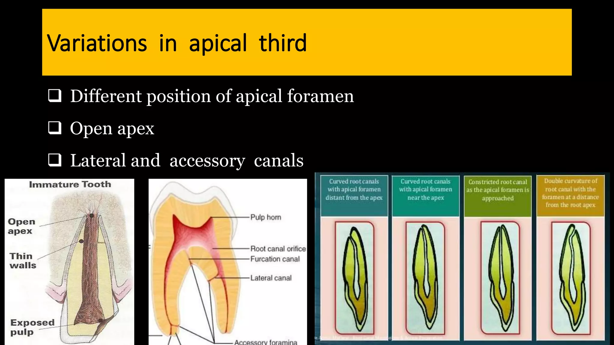 Internal Anatomy of Pulp cavity | PPTX