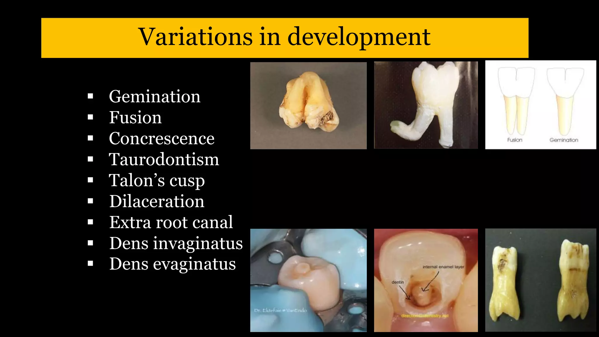 Internal Anatomy of Pulp cavity | PPTX