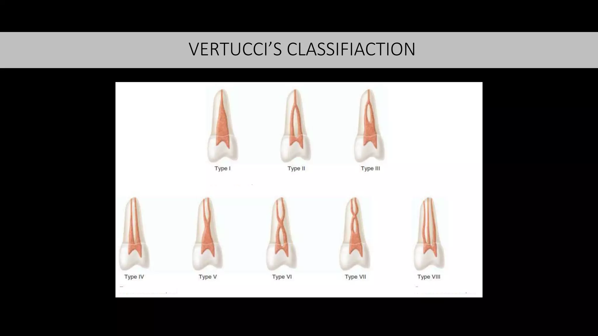 Internal Anatomy of Pulp cavity | PPTX